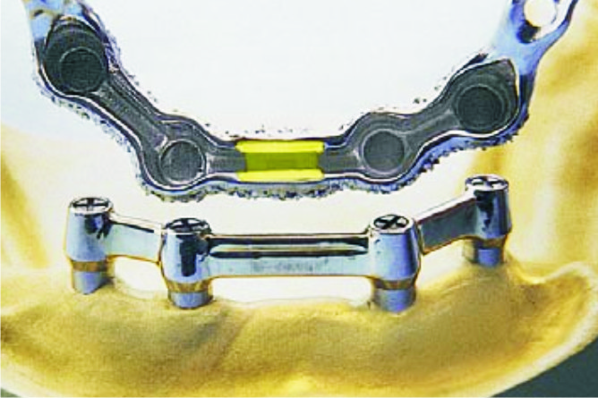 2U7-Instrumentos y Utensilios bredent